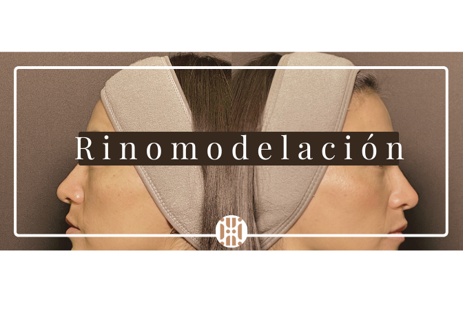 Rinomodelación: mejora tu nariz sin quirófano